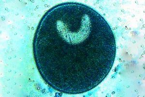 ENFERMEDAD ICH 】Punto blanco en peces ≫ Diagnosticar y tratar